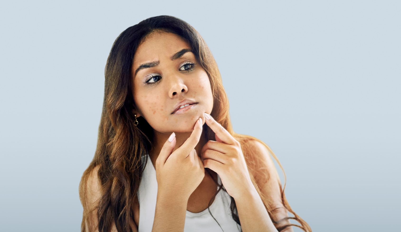 Acne Treatment and Prescription | Shoppers Drug Mart™
